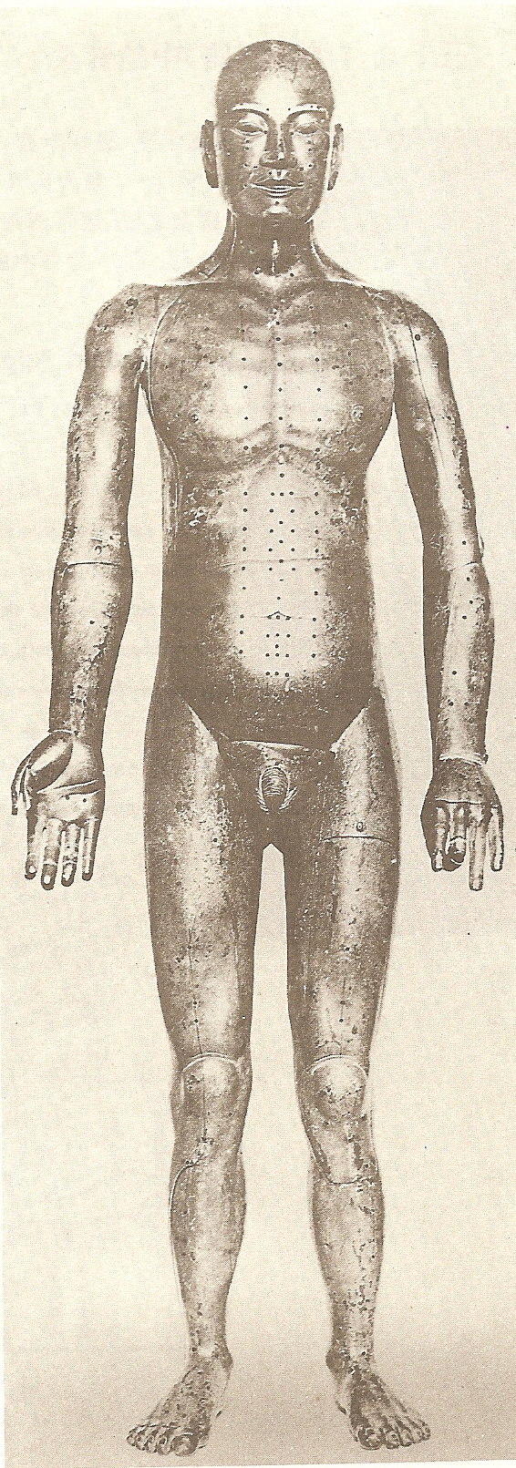 About acupuncture | Southport Acupuncture Clinic